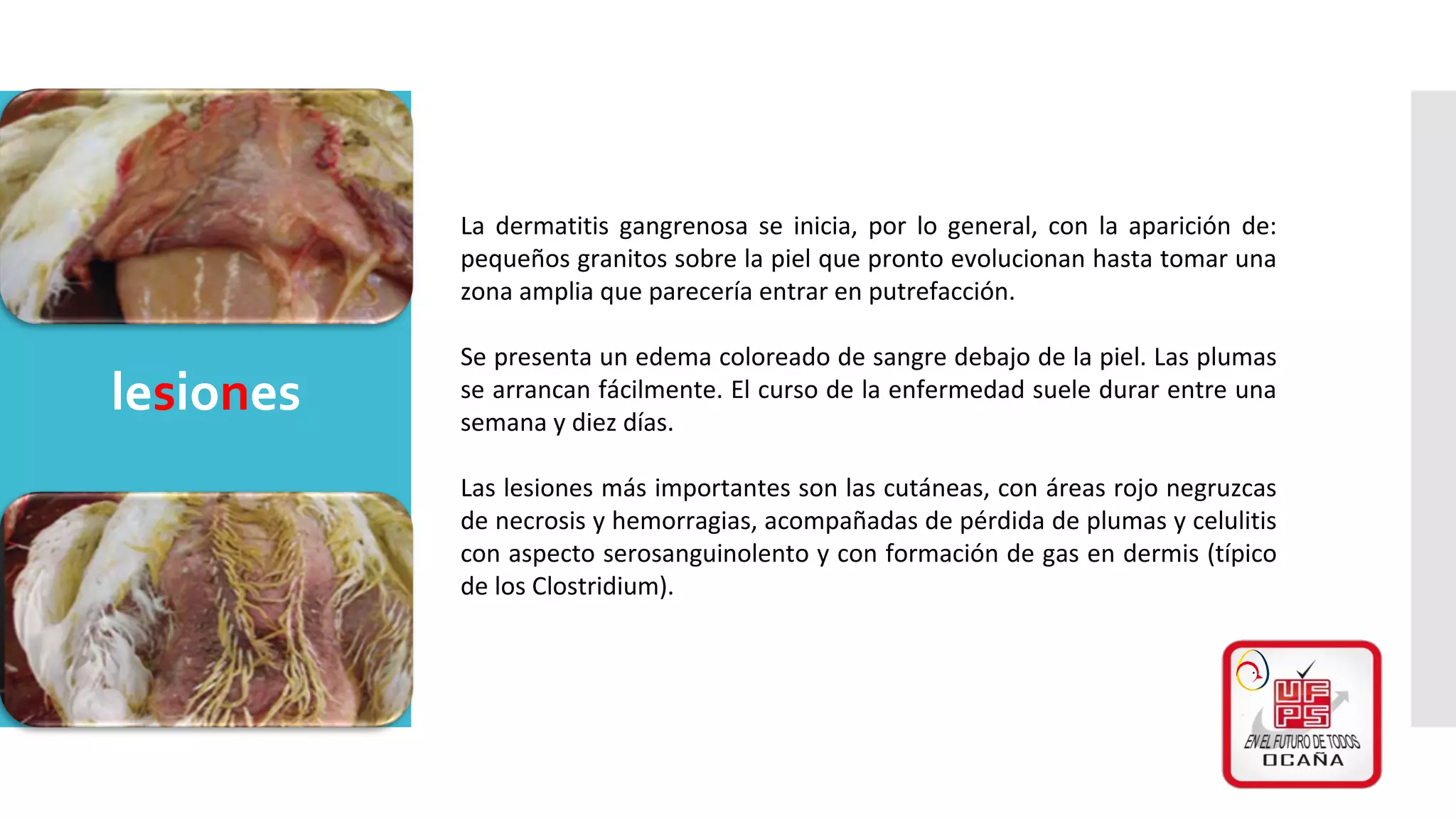 Enfermedad Bacterial / Dermatitis