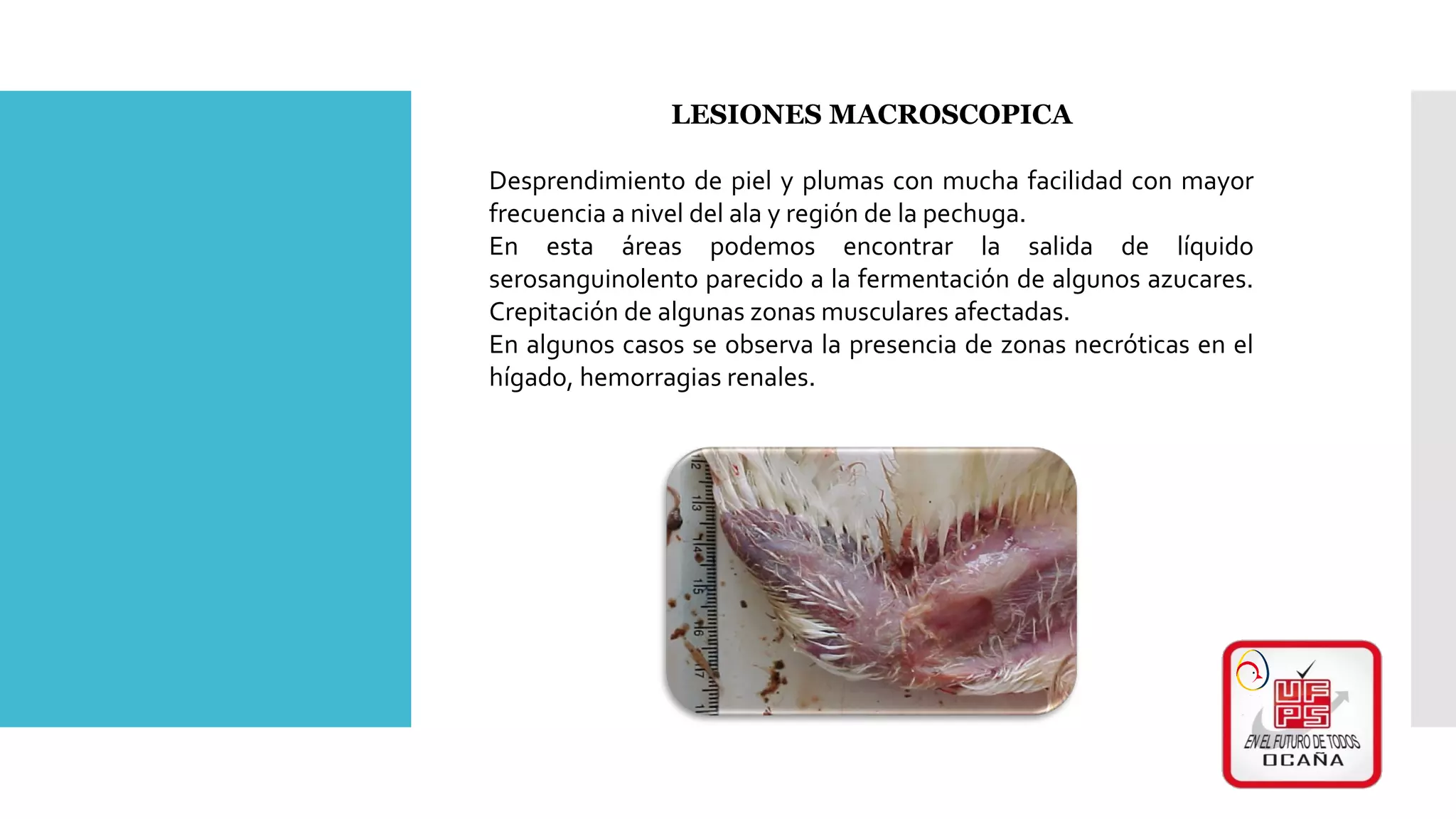 Enfermedad Bacterial / Dermatitis