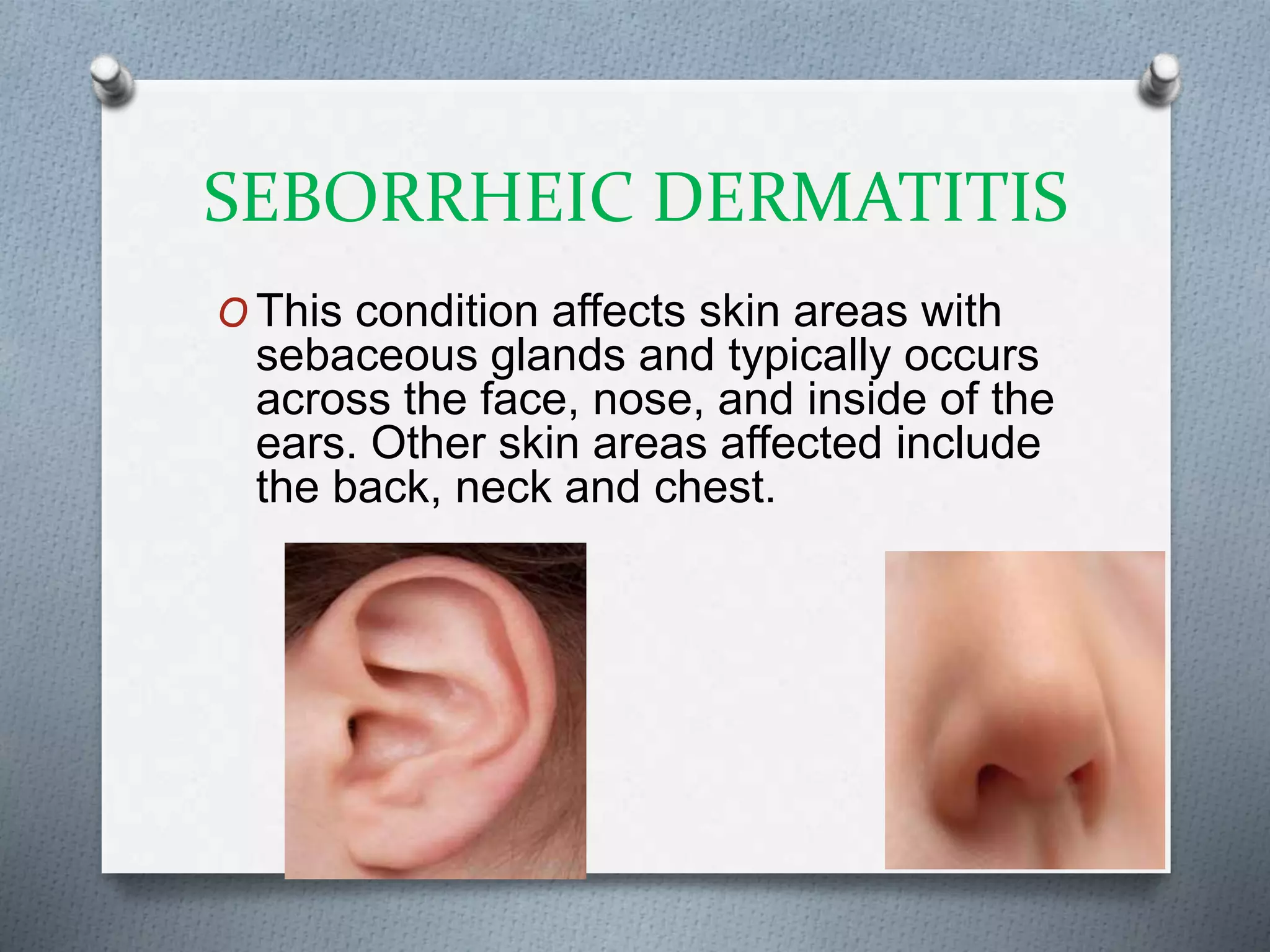 Dermatitis | PPTX