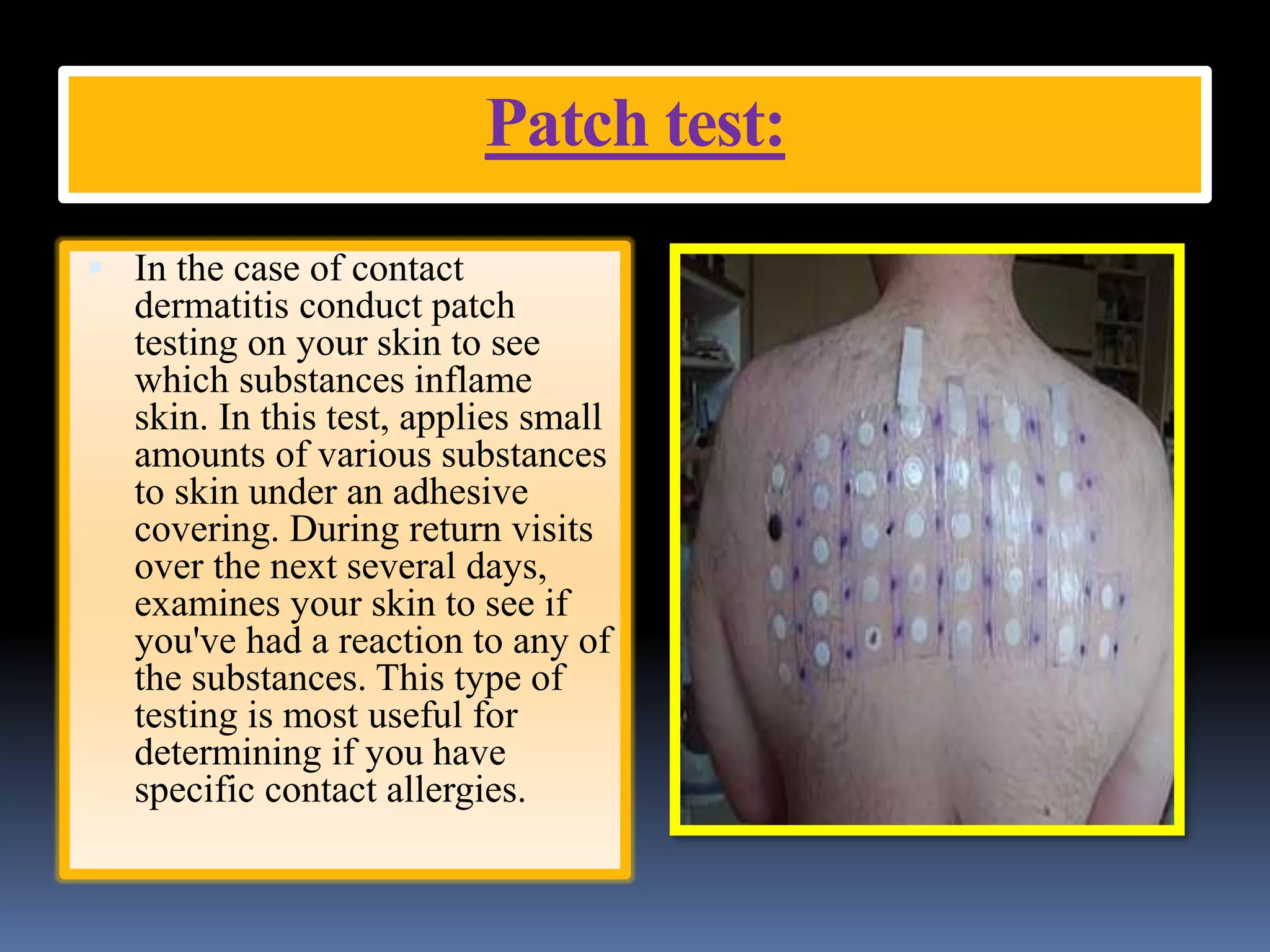 Dermatitis | PPTX