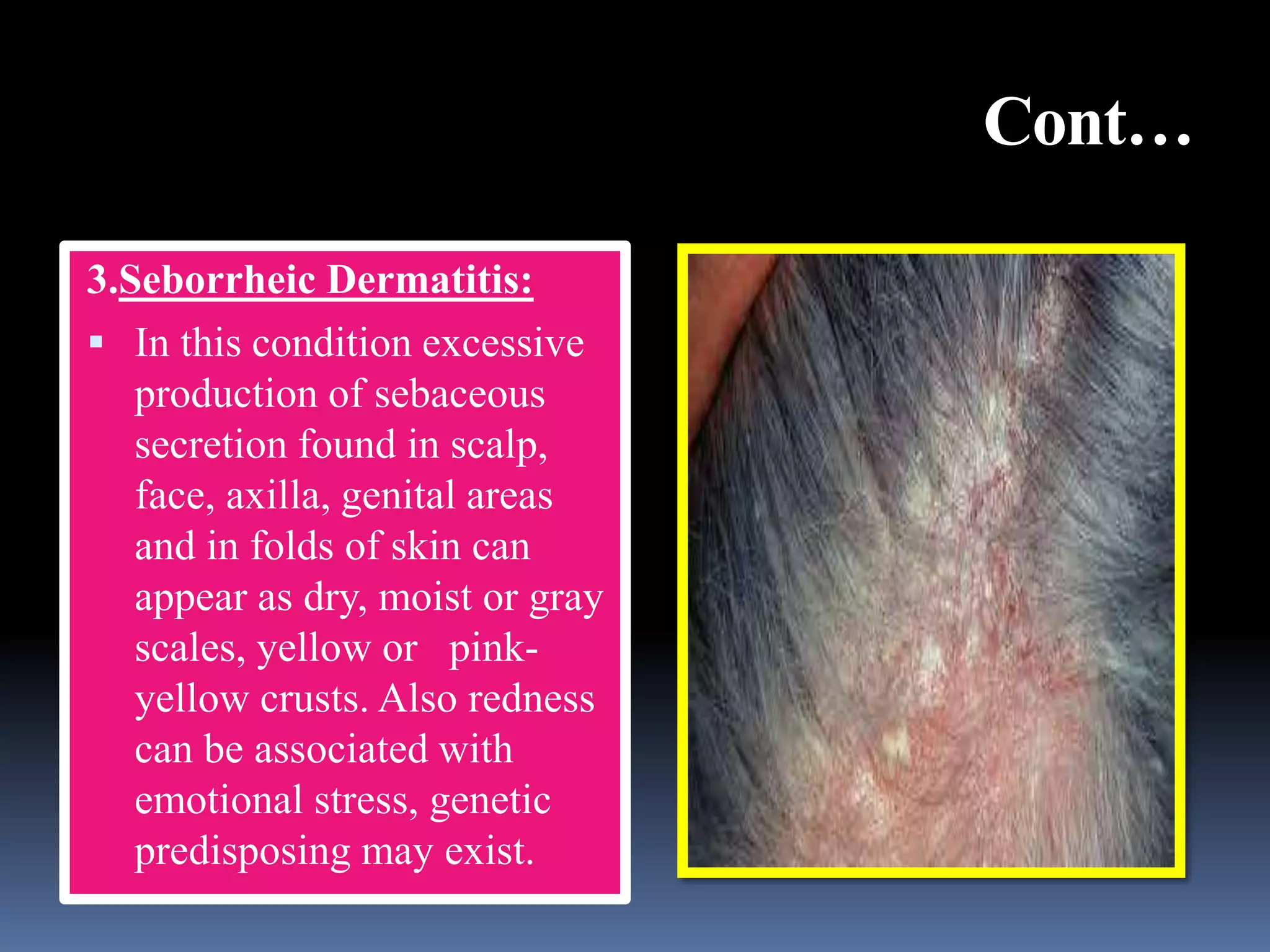 Dermatitis | PPTX