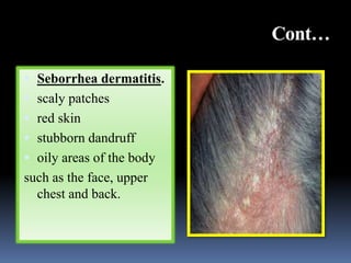 Dermatitis | PPTX