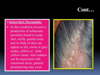 Dermatitis | PPTX