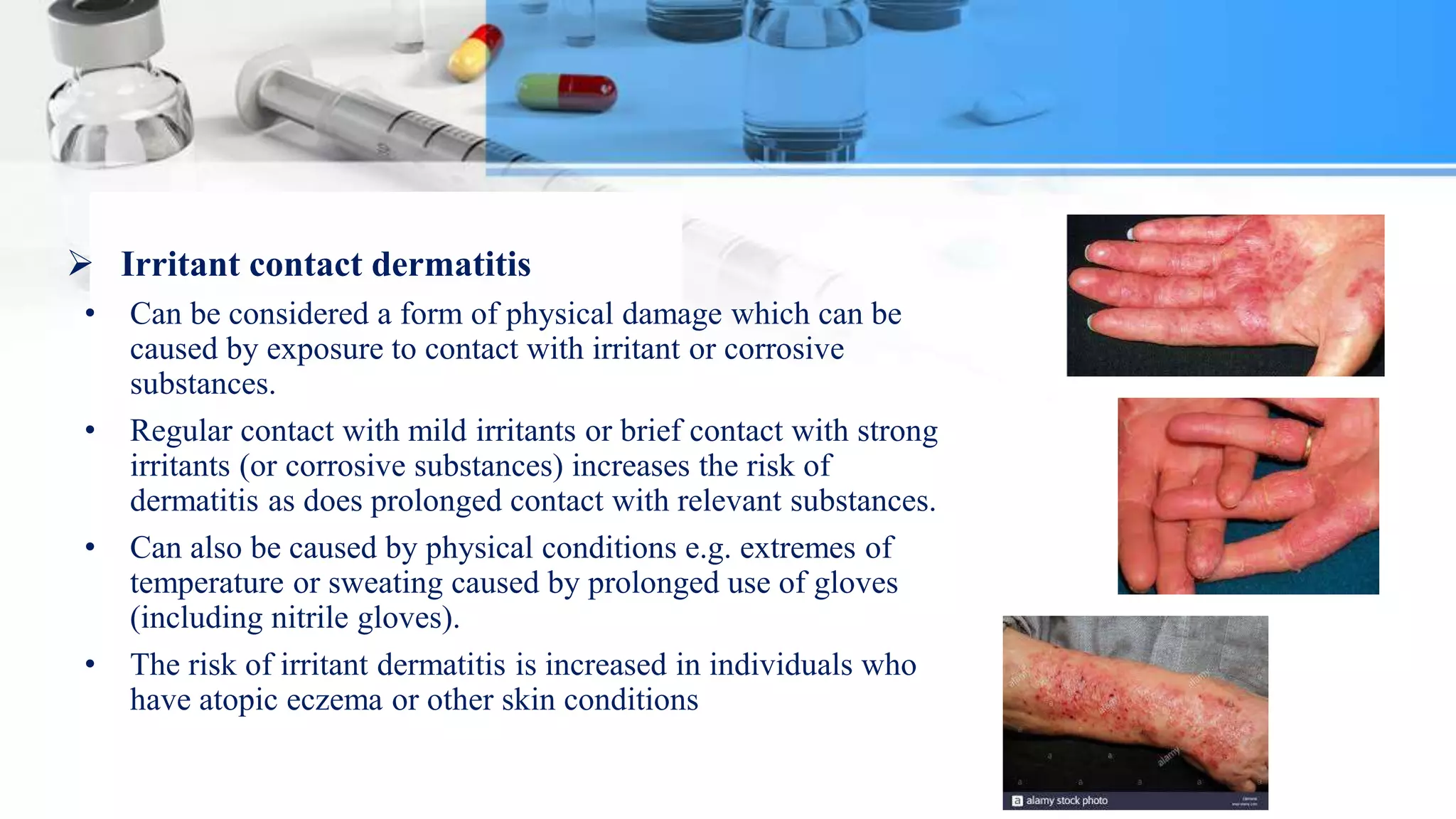 Dermatitis.pptx
