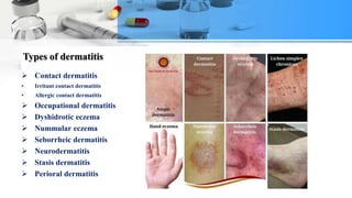 Dermatitis.pptx