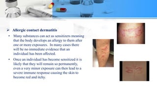Dermatitis.pptx