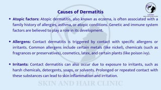 Dermatitis Treatment | PPT
