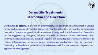 Dermatitis Treatment | PDF