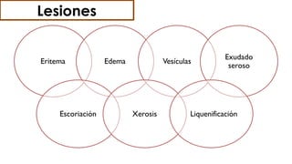 DERMATITIS ATOPICA - PRURIGO NODULAR- INTERTRIGO PEDIATRIA | PPTX