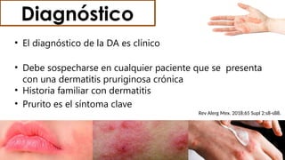 DERMATITIS ATOPICA - PRURIGO NODULAR- INTERTRIGO PEDIATRIA | PPTX