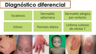DERMATITIS ATOPICA - PRURIGO NODULAR- INTERTRIGO PEDIATRIA | PPTX