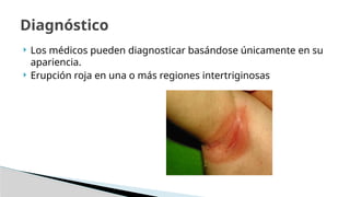 DERMATITIS ATOPICA - PRURIGO NODULAR- INTERTRIGO PEDIATRIA | PPTX