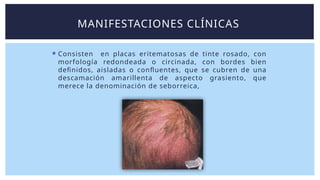 DERMATITIS ATOPICA - PRURIGO NODULAR- INTERTRIGO PEDIATRIA | PPTX