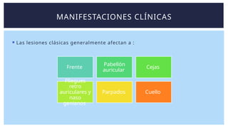 DERMATITIS ATOPICA - PRURIGO NODULAR- INTERTRIGO PEDIATRIA | PPTX