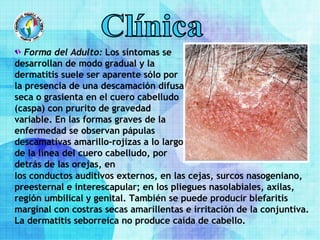 Dermatitis Seborreica | PPT