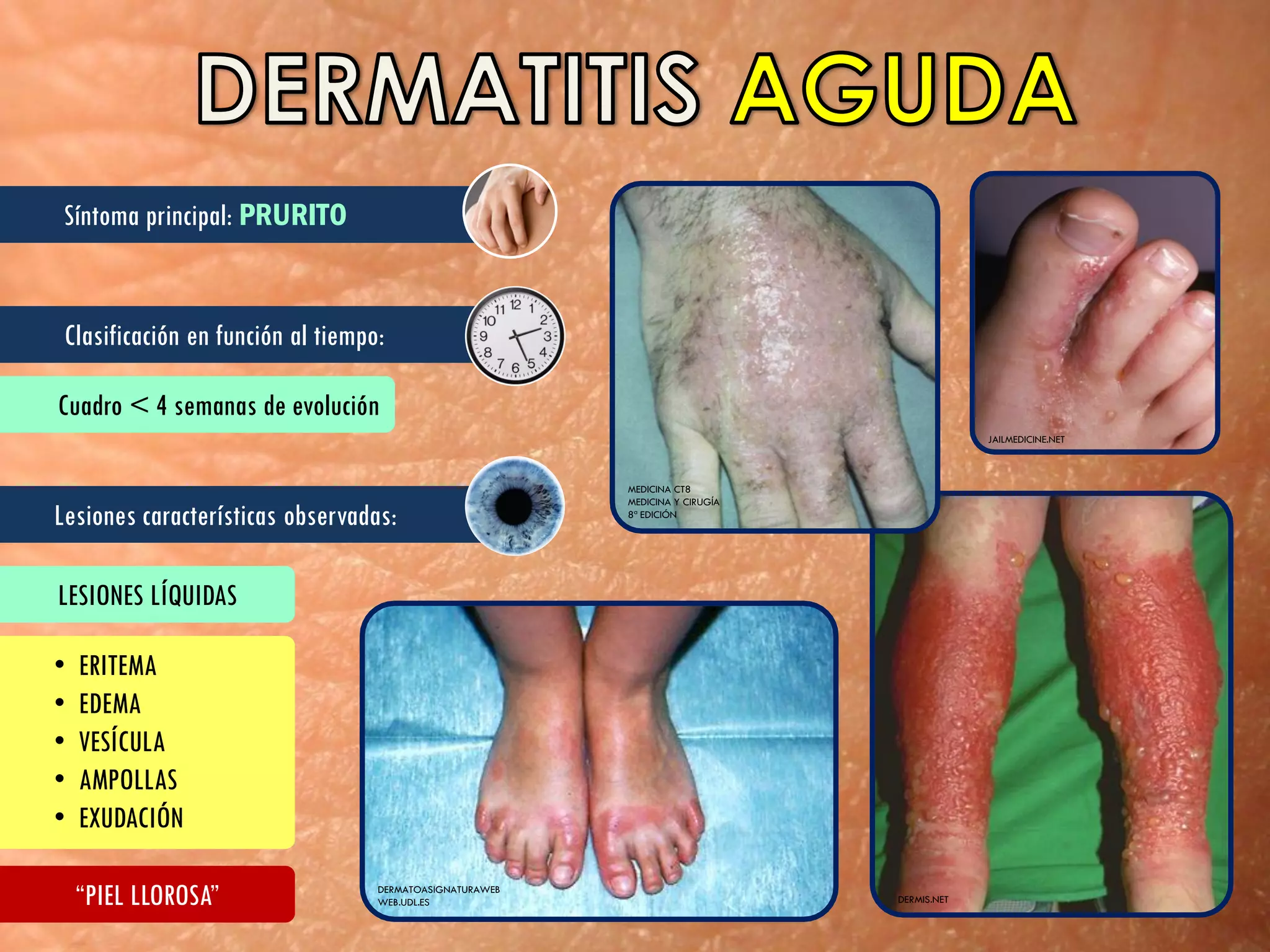 Dermatitis Aguda & Subaguda | PDF