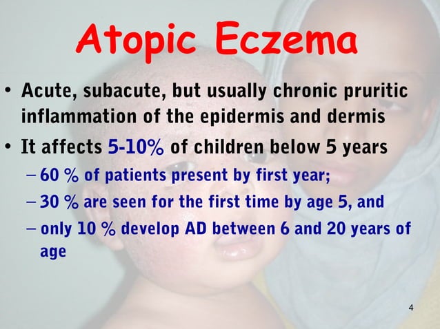 Eczema And Dermatitis Overview And More Hdrwpt
