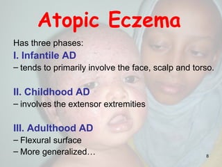 Dermatitis and eczema | PPT