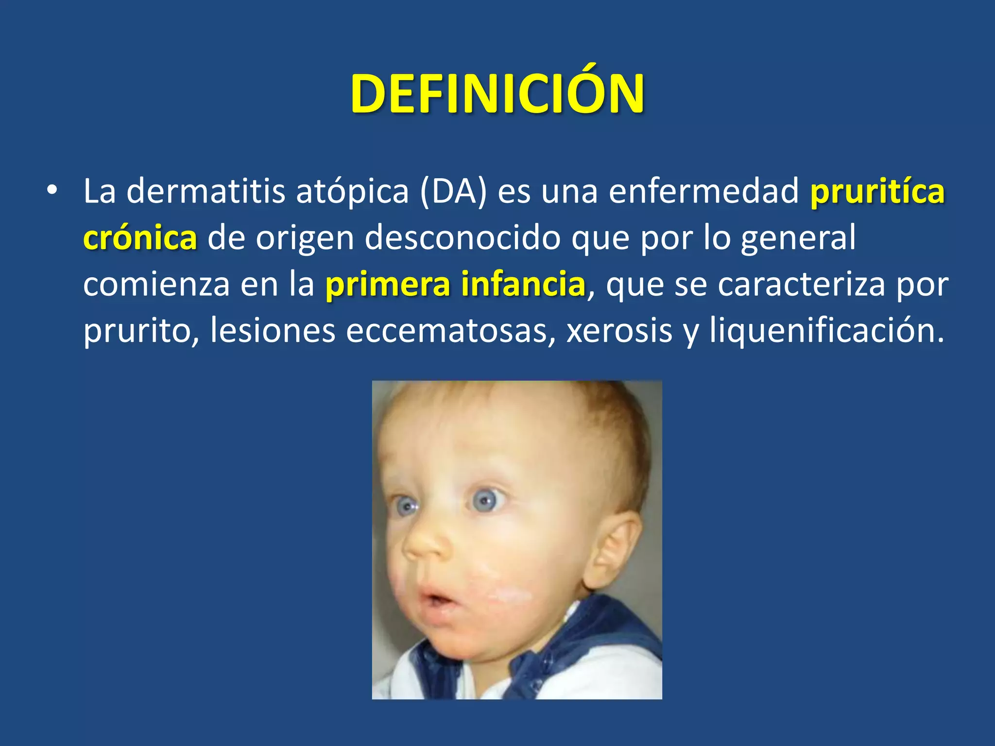 Dermatitis atopica | PPTX