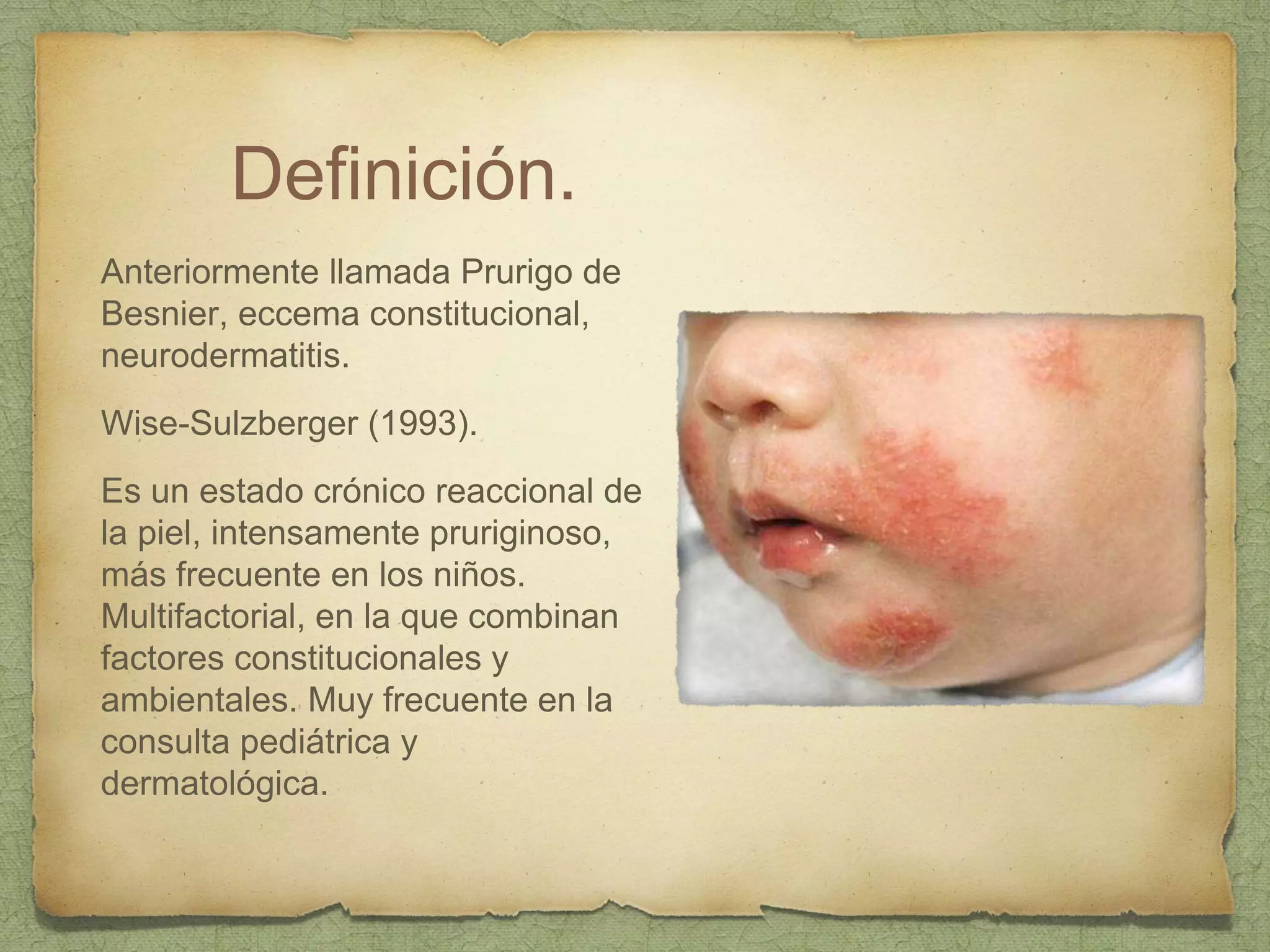 Dermatitis atópica. Dermatología. | PPT