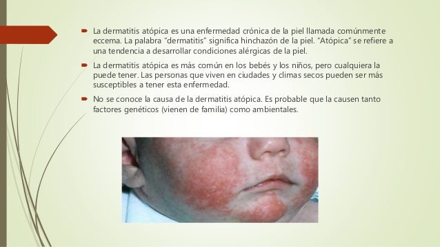 Qu Es La Dermatitis Atpica Sntomas Causas Y Cmo Qué es la dermatitis atópica: síntomas, causas y ...