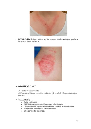 (2024-01-30). DESCIFRANDO LA DERMATITIS ATOPICA (DOC) | DOCX