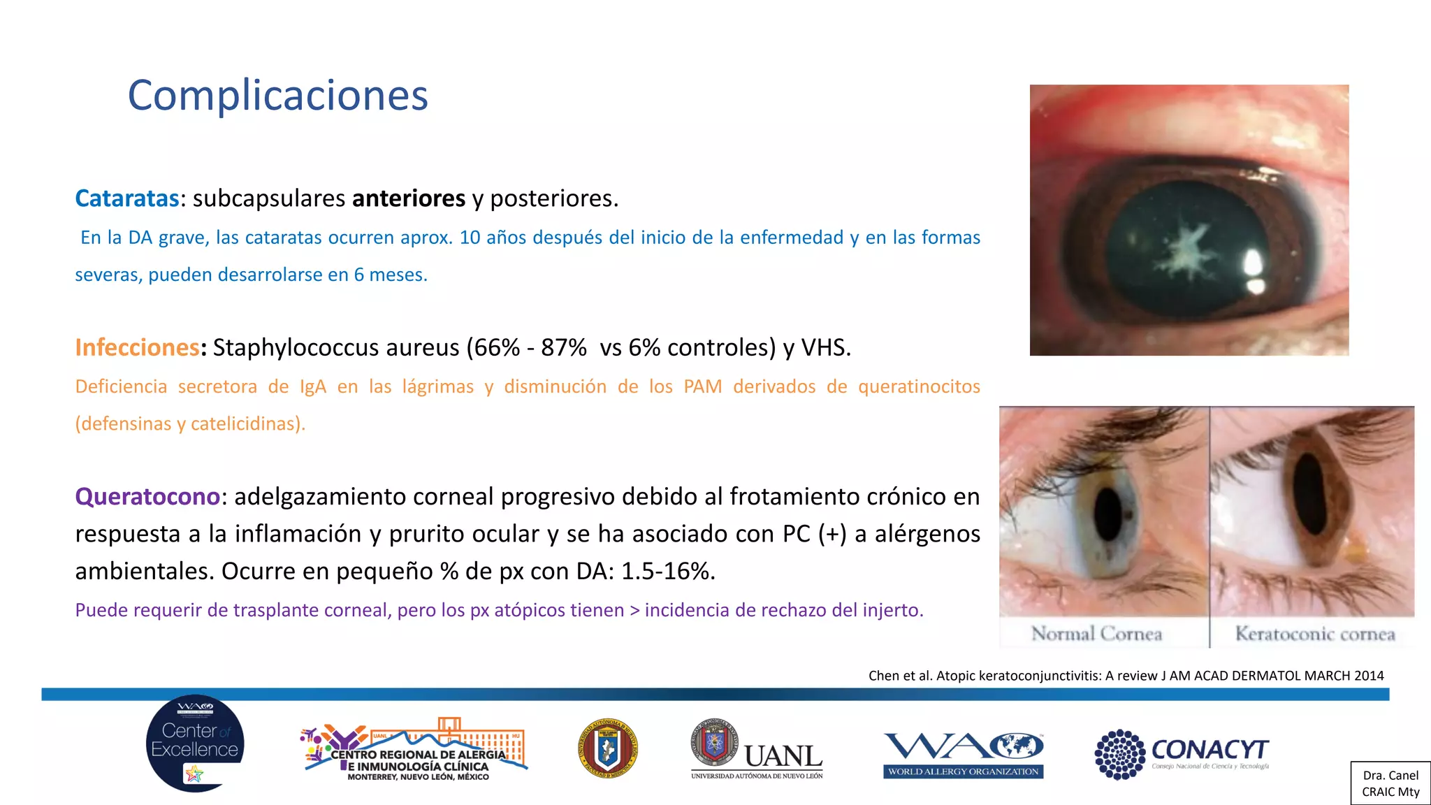 Dermatitis atópica con queratoconjuntivitis atópica | PDF