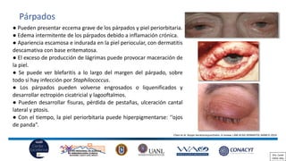 Dermatitis atópica con queratoconjuntivitis atópica | PDF