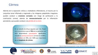 Dermatitis atópica con queratoconjuntivitis atópica | PDF