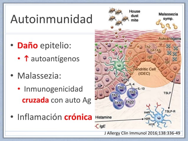 Dermatitis Atópica Mecanismos De Daño Prof Dr José A Ortega Martell