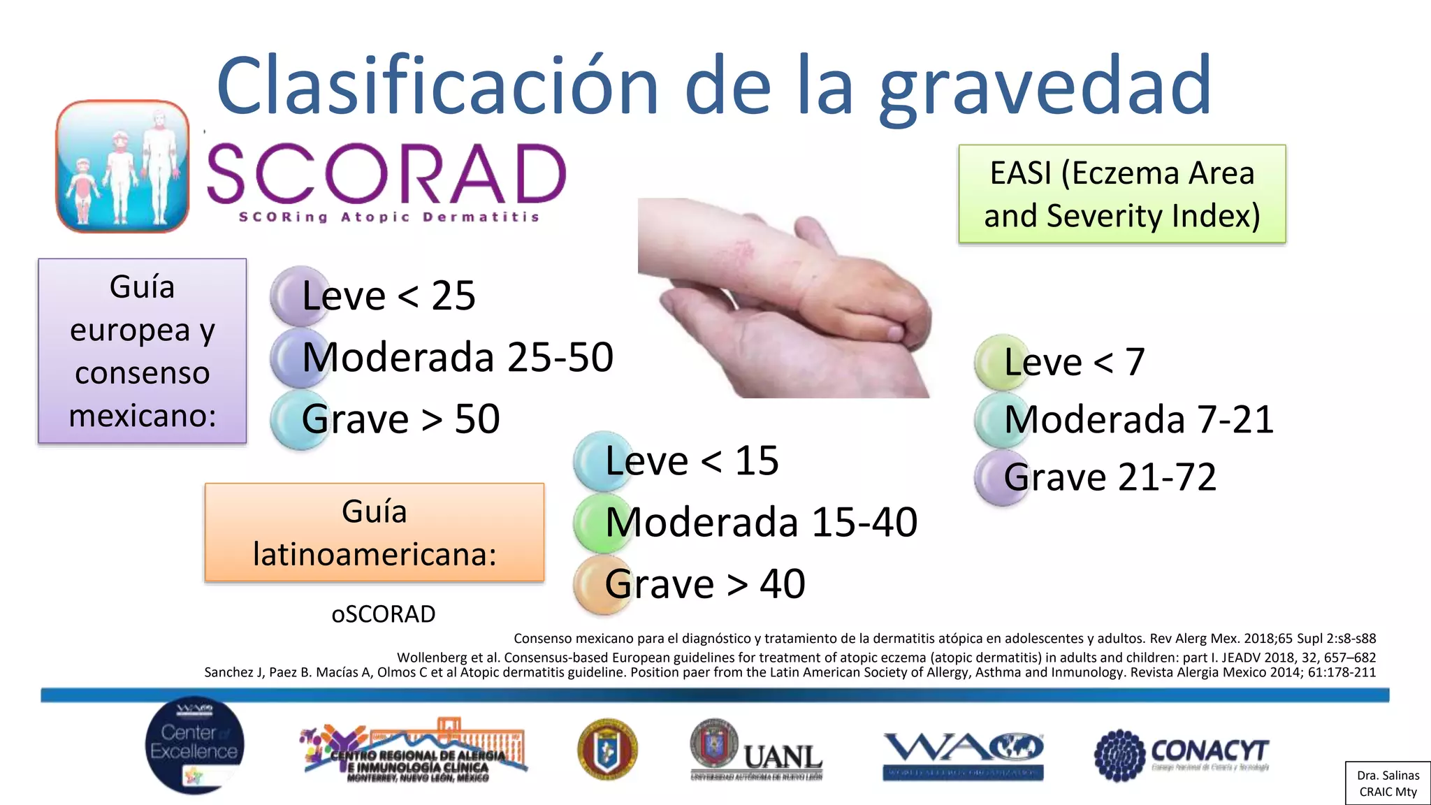 Dermatitis atópica sesión clínica | PDF