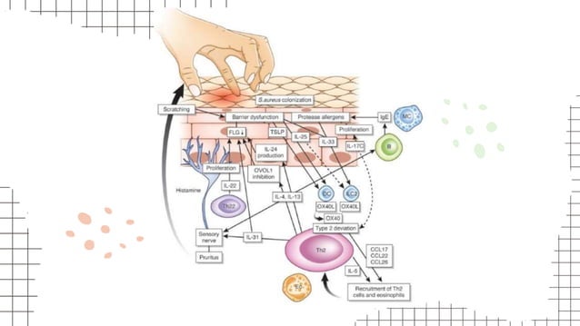 Dermatitis Atopik Dermatitis Atopik Dermatitis Atopik | PPTX