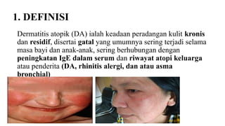 Materi tentang Dermatitis Atopik baru.pptx