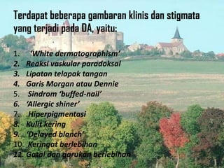Dermatitis atopik & urtikaria | PPTX