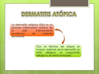 Dermatitis atópica | PPTX