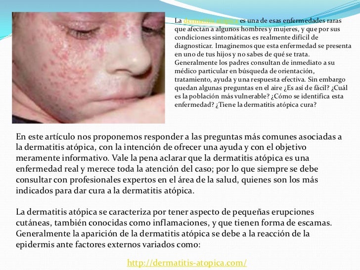 Qu Es La Dermatitis Atpica Sntomas Causas Y Cmo Qué es la dermatitis atópica: síntomas, causas y ...