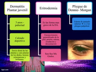 Dermatitis atópica | PPTX | Skin and Dermatology | Diseases and Conditions