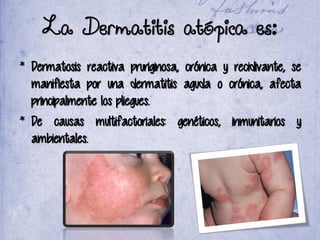 Qu Es La Dermatitis Atpica Sntomas Causas Y Cmo Qué es la dermatitis atópica: síntomas, causas y ...