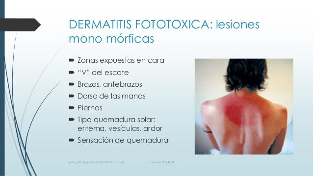 DERMATITIS DE CONTACTO PRESENTACION