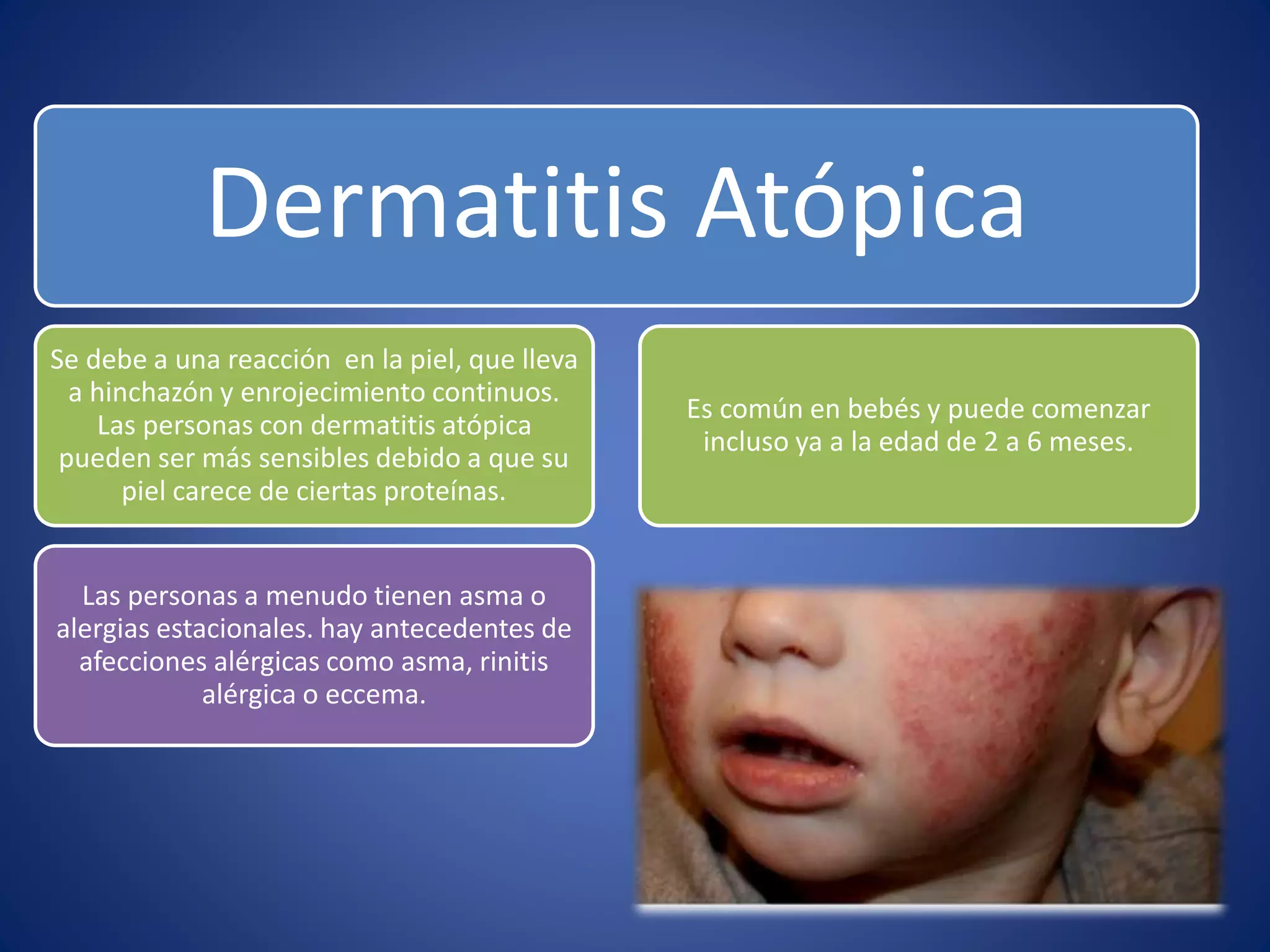Dermatitis eccemotasas | PPTX