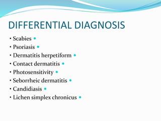 Dermatitis (eczema) | PPTX