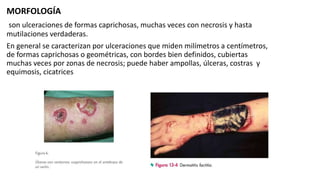 dermatitis facticia.pptx