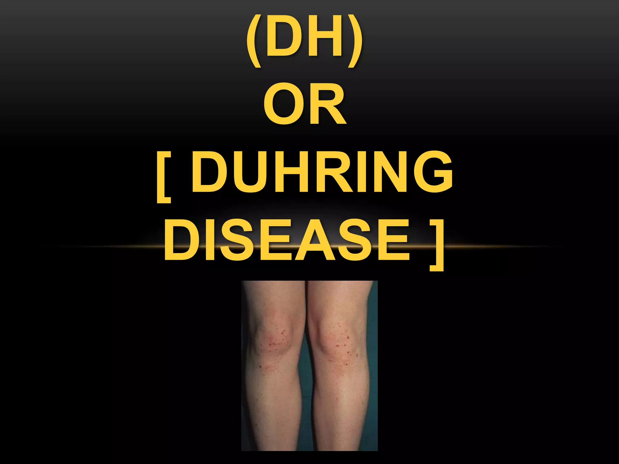 Dermatitis herpetiformis (dh) | PPTX