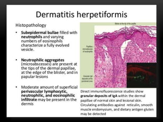 Dermatitis herpetiformis (dh) | PPTX
