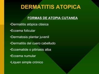 Dermatitis inflamatorias de la piel | PDF