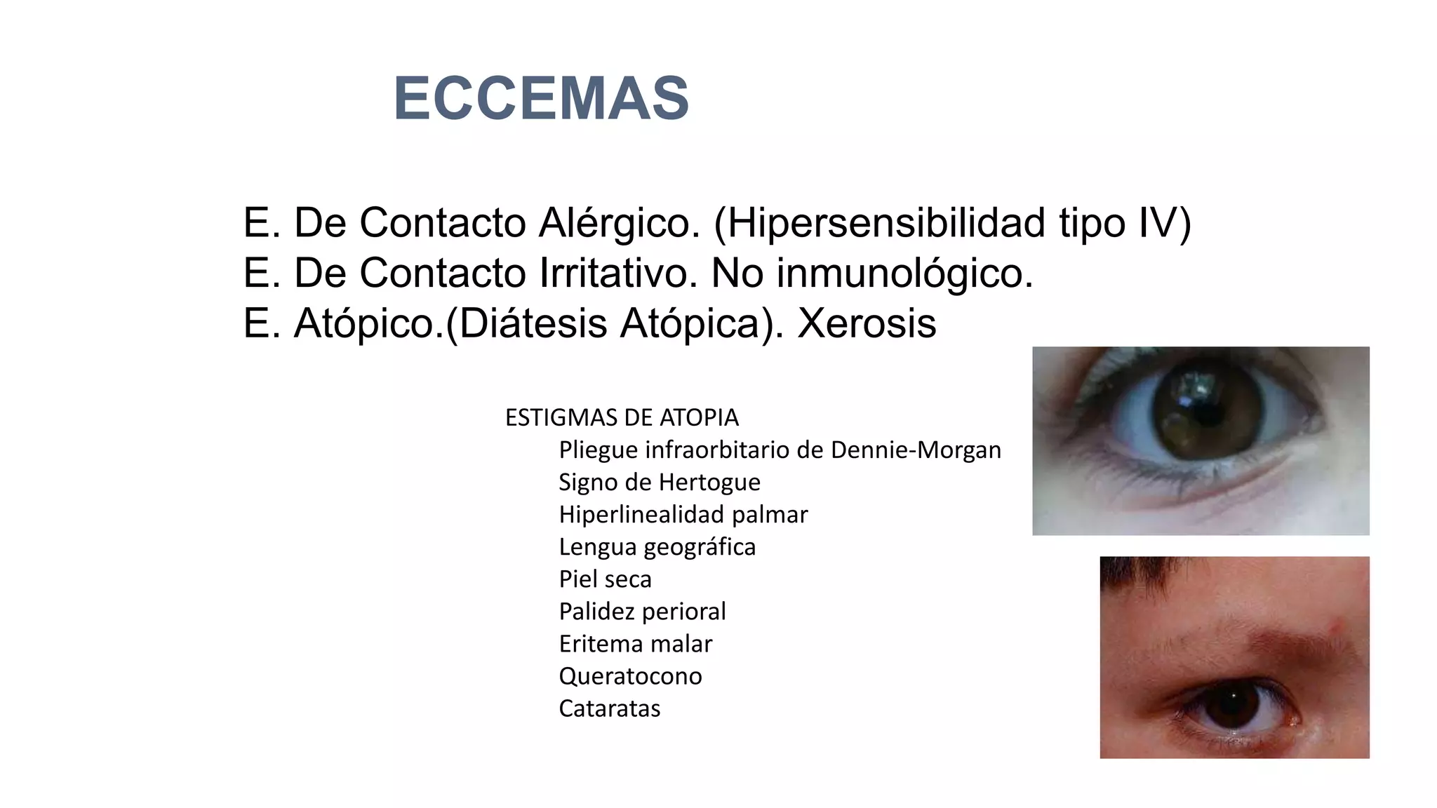 DERMATITIS POR CONTACTO.pptx