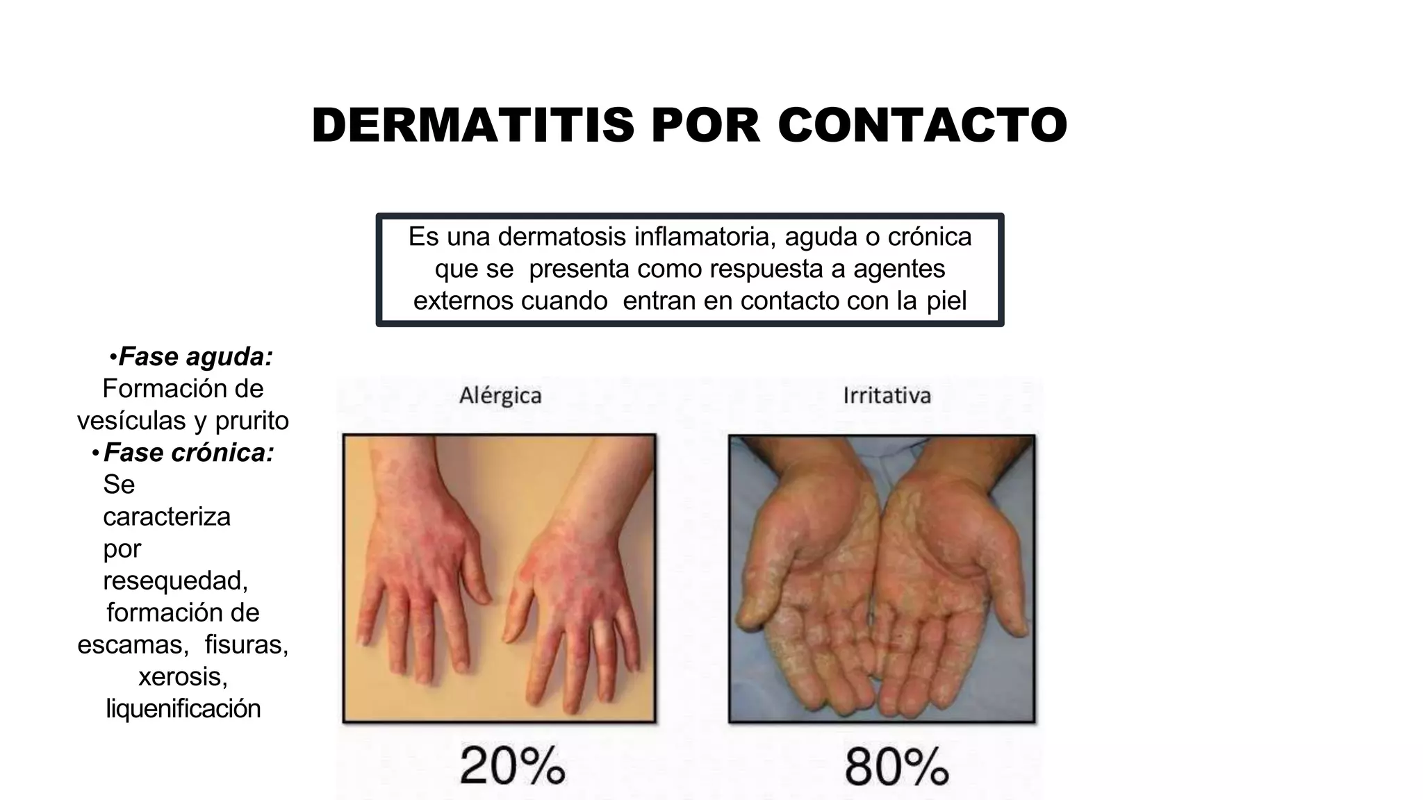 DERMATITIS POR CONTACTO.pptx