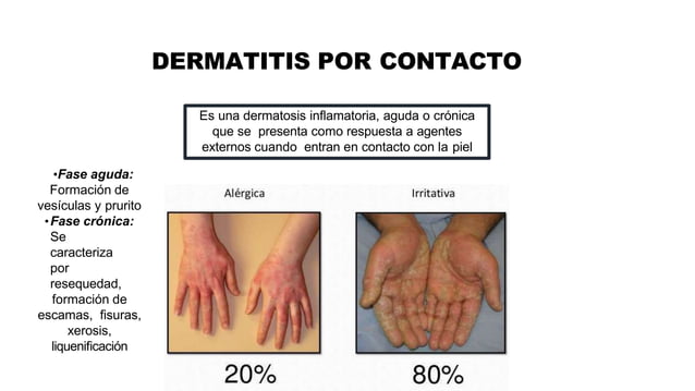 DERMATITIS POR CONTACTO.pptx
