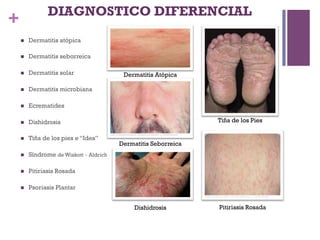 Dermatitis por Contacto/Dermatitis zona de pañal/ Prurigo Actinico | PDF