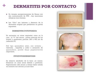 Dermatitis por Contacto/Dermatitis zona de pañal/ Prurigo Actinico | PDF